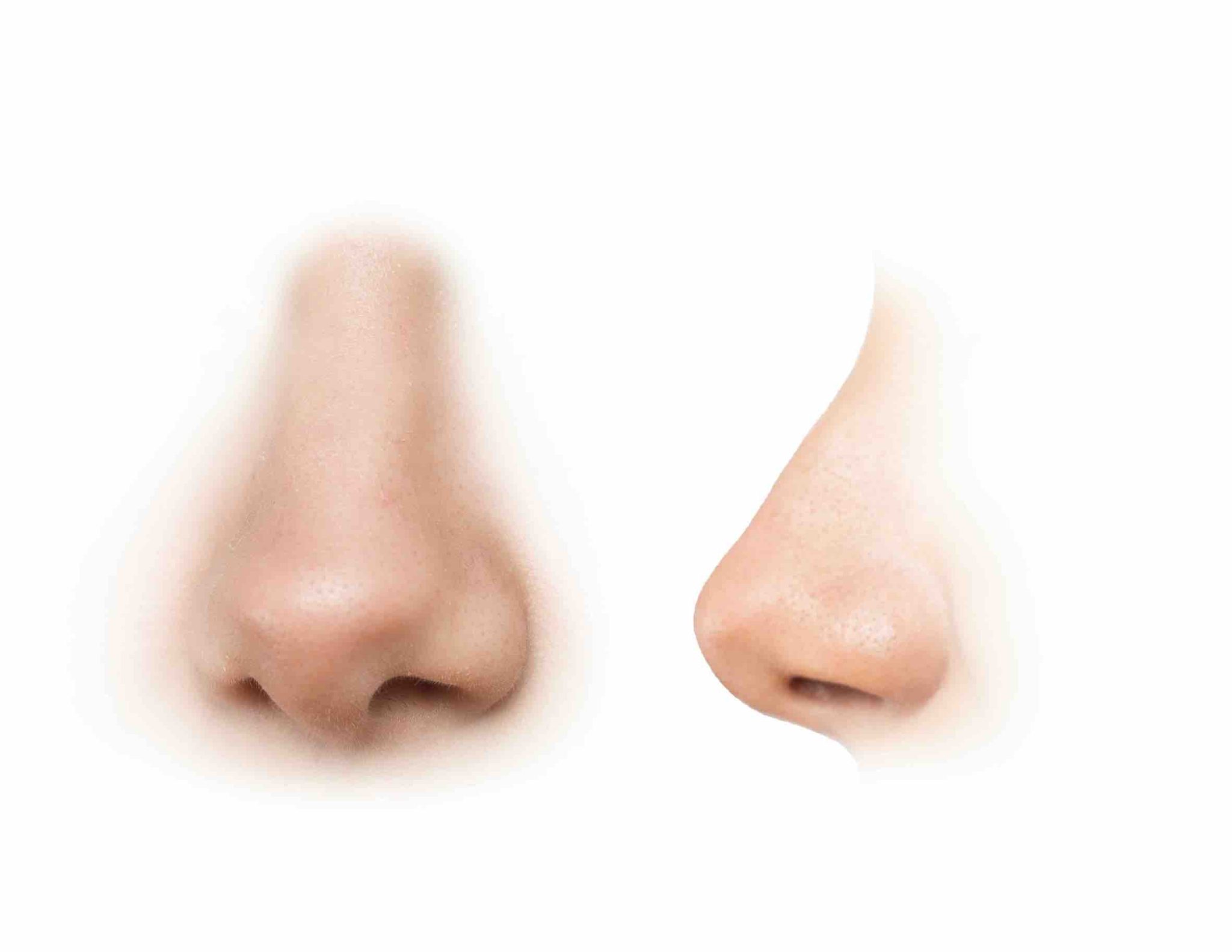 How to Make Wide Nose Smaller - Dr. Mark Doyle