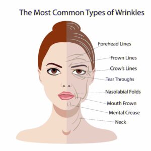 How to Lift Eyebrows | Gold Coast Plastic Surgeon Dr Mark Doyle