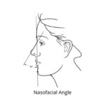What Is the Most Attractive Nose Shape? | Dr Mark Doyle